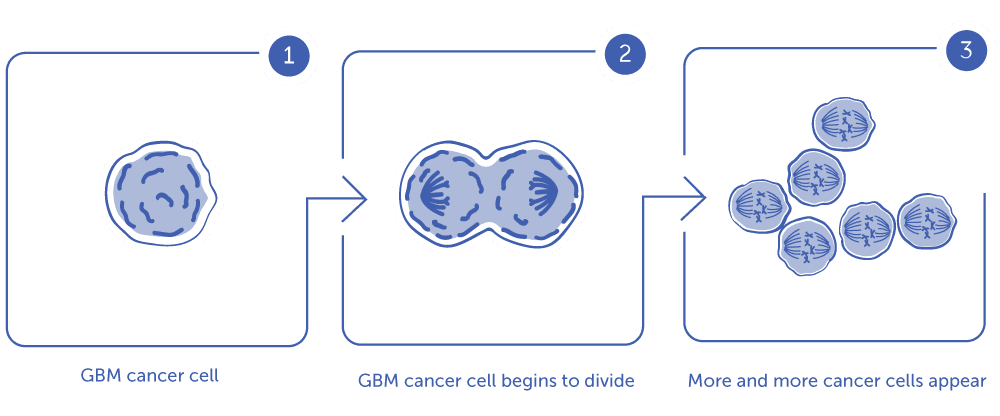 How Optune Gio Works® | Optune Gio®